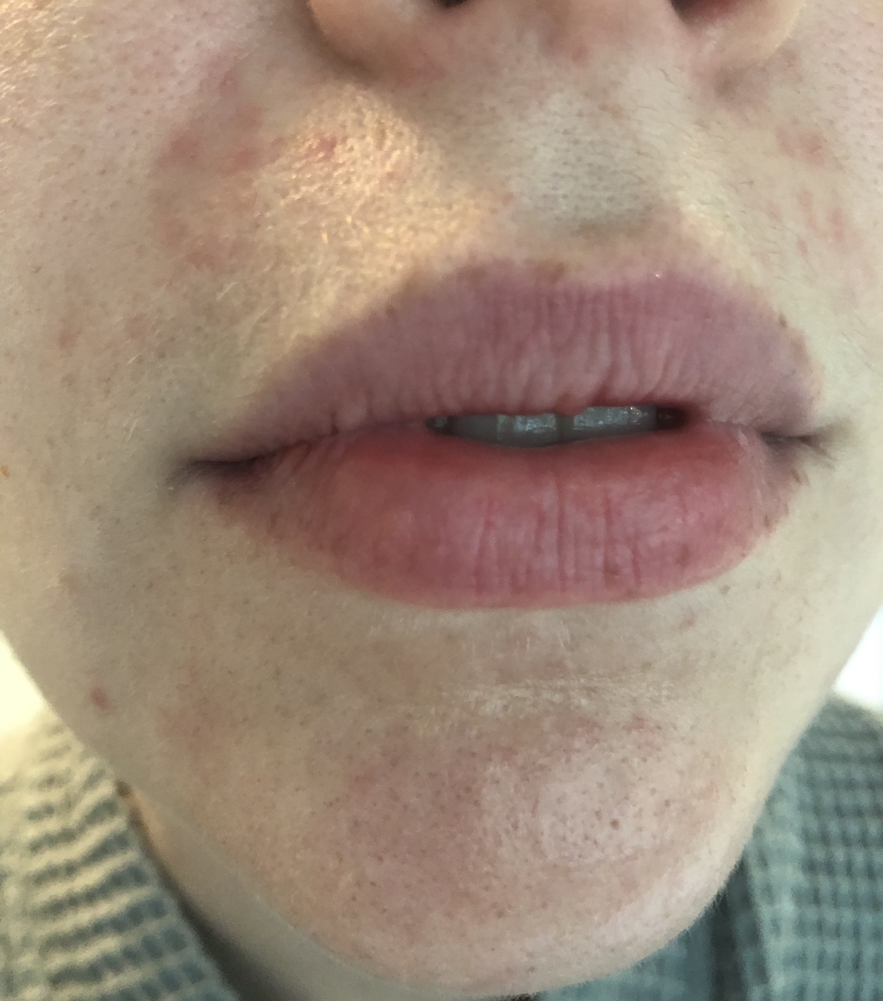 The Facial that Left me Speechless - Pretty Little Fawn